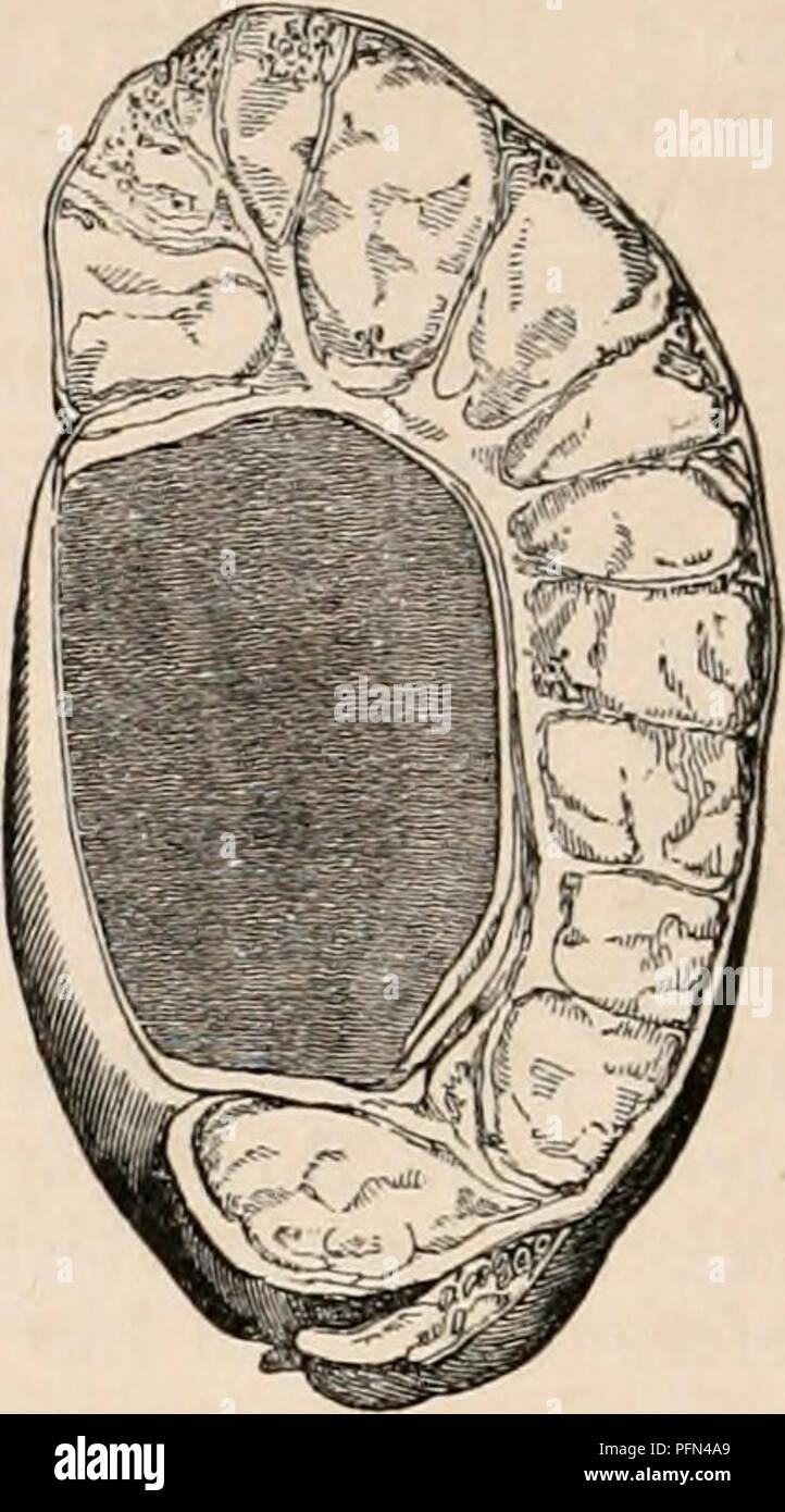 Indurated hi-res stock photography and images - Alamy