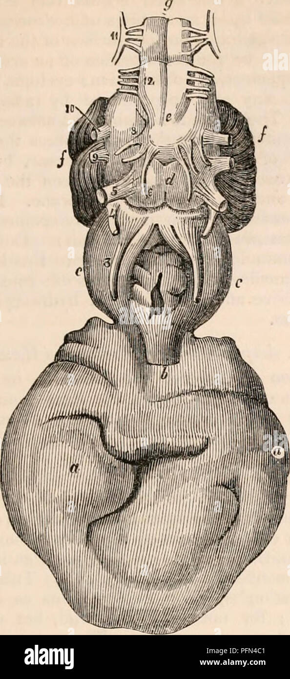 Birth deformities hi-res stock photography and images - Alamy