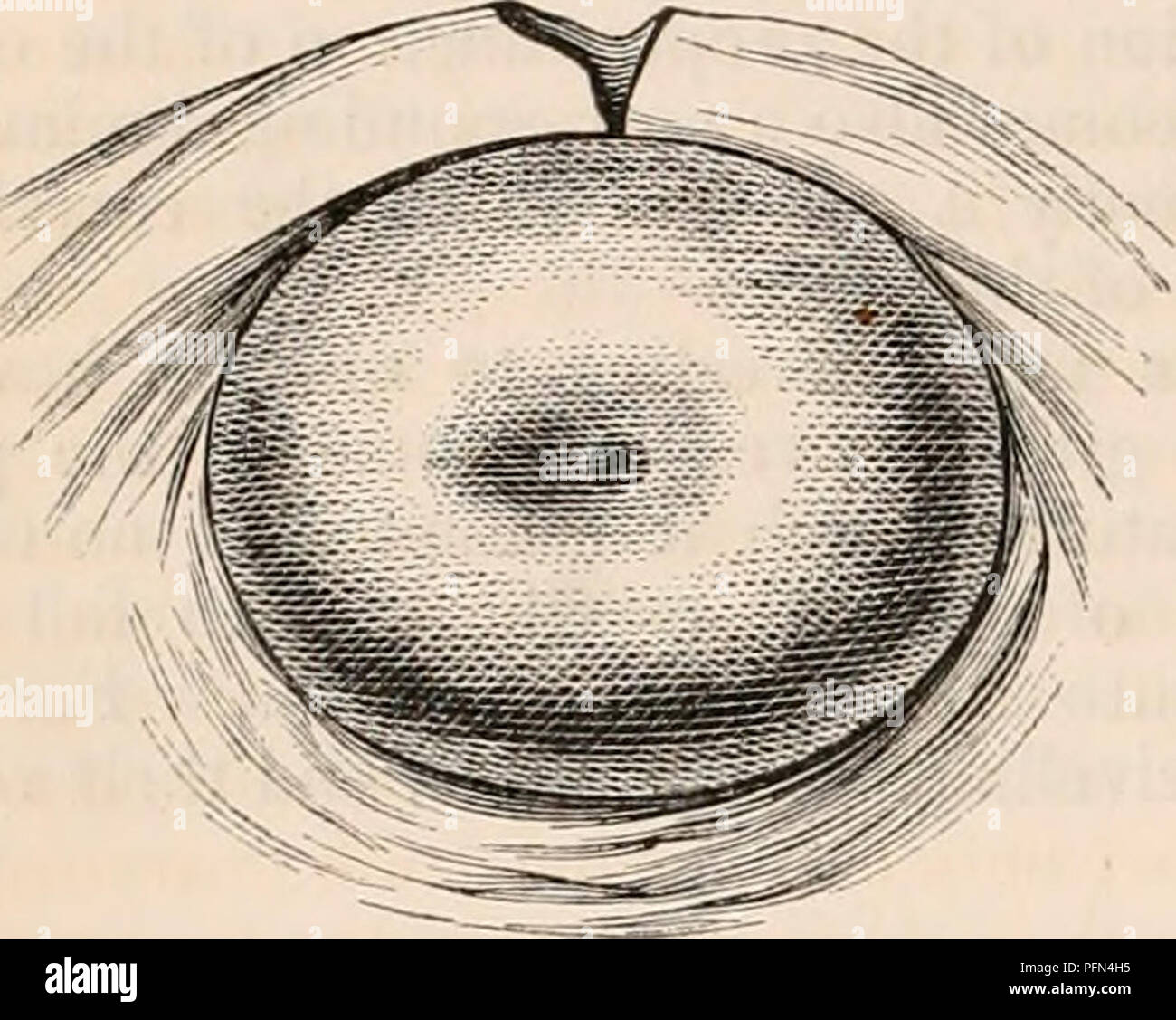 Uterine orifice hi-res stock photography and images - Alamy