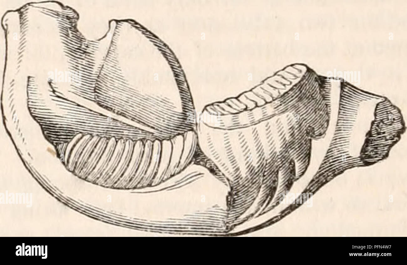Posterior tooth hi-res stock photography and images - Alamy