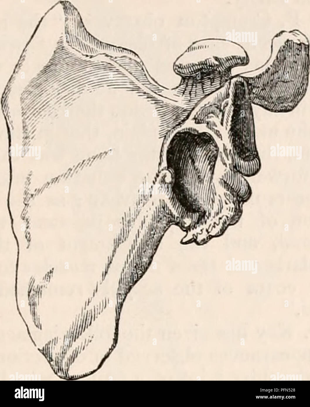 The shoulder joint's abnormal conditions, specifically dislocations and ...