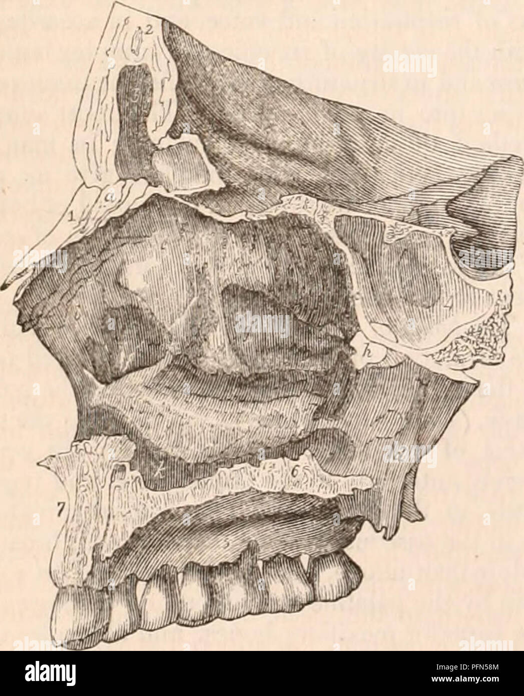 Vomer bone hi-res stock photography and images - Alamy