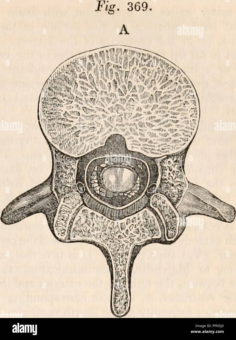 Spinal Cord Arachnoid Mater