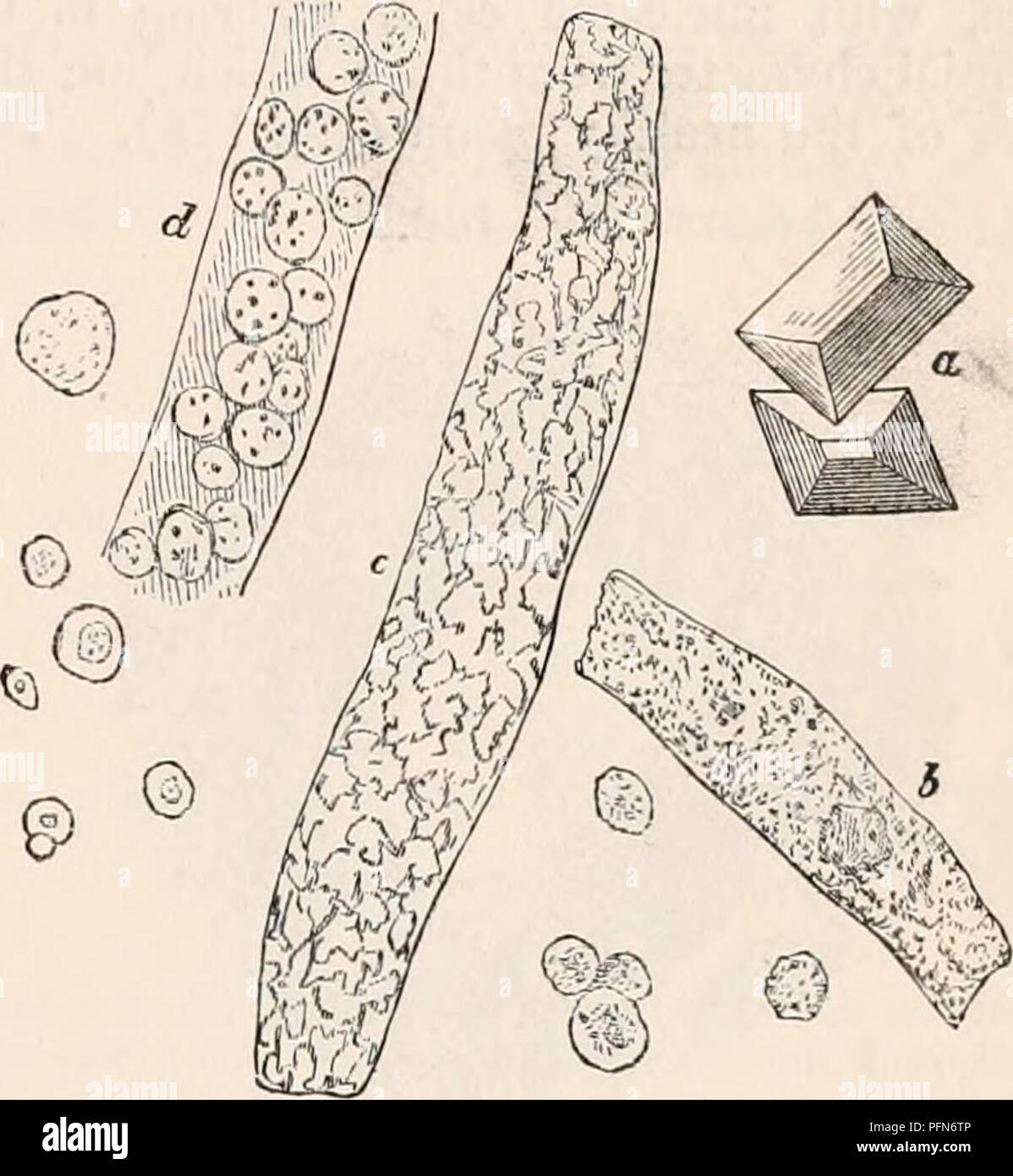 Scrofulous hi-res stock photography and images - Alamy