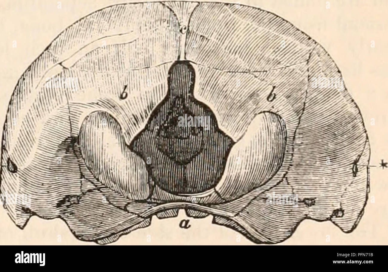 Ex occipital hi-res stock photography and images - Alamy