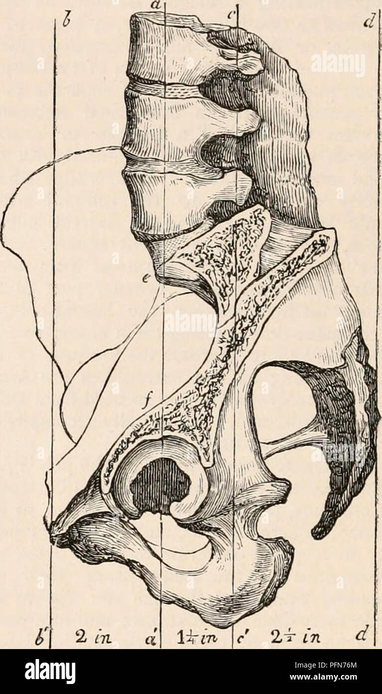 Body deformations hi-res stock photography and images - Alamy
