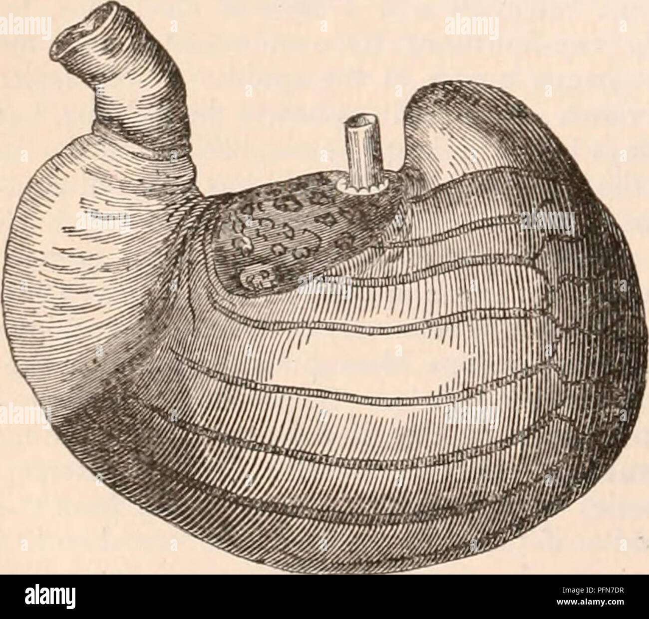 This entry in the 'Cyclopædia of Anatomy and Physiology' explores the ...
