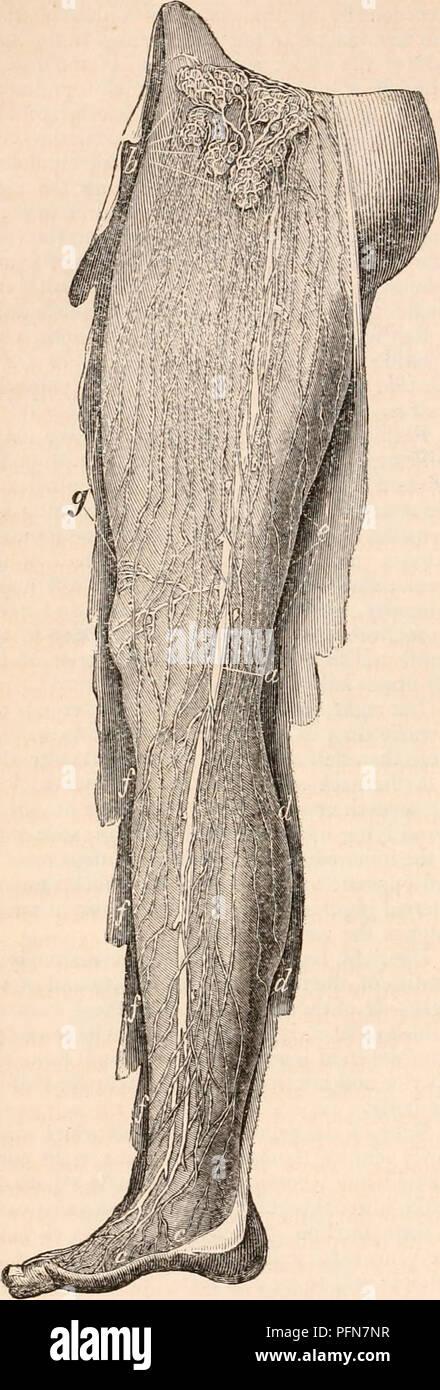 This image shows a diagram of the superficial lymphatics of the lower ...
