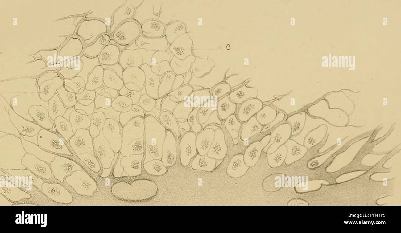 Granulation tissue hi-res stock photography and images - Alamy