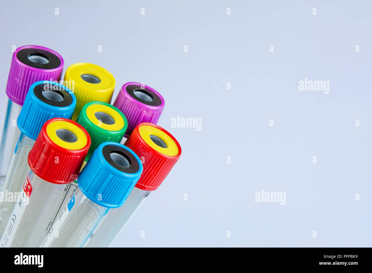 Test tubes with blood samples isolated on white background Stock Photo ...