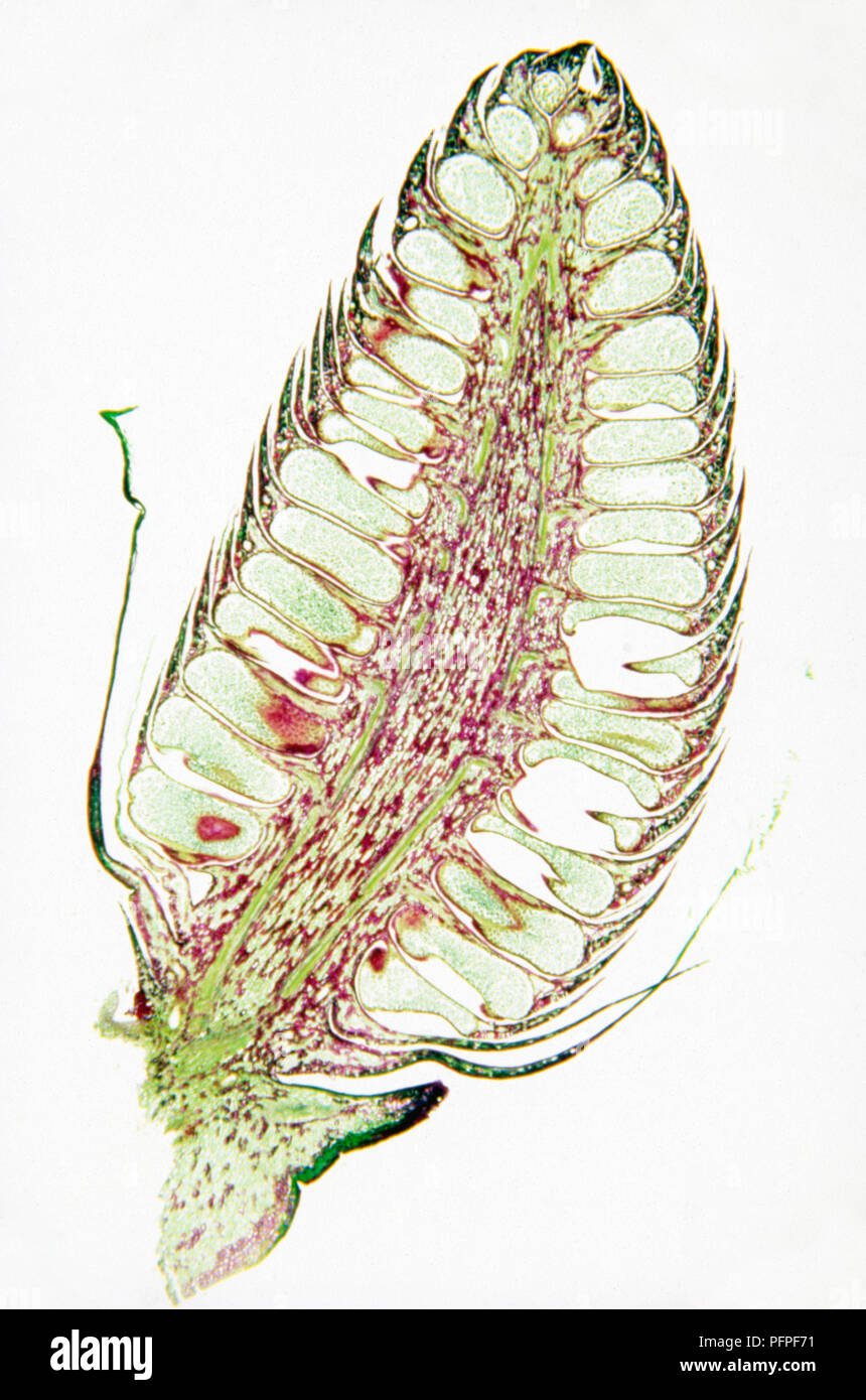 Micrograph of longitudinal section through young male cone Stock Photo ...