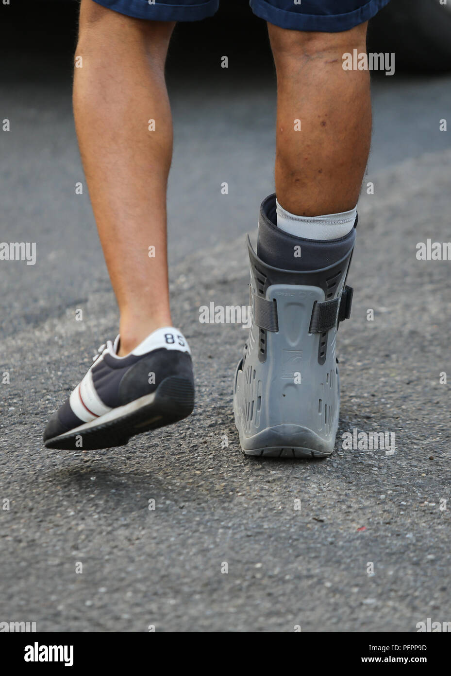 Details of an injured leg in an orthosis of a patient going to the ...