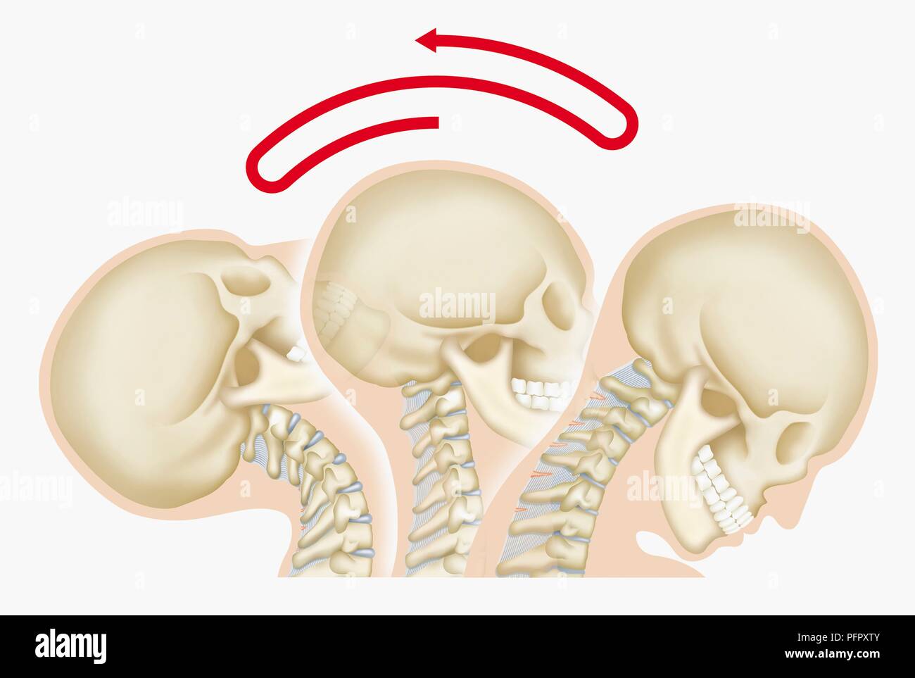 Illustration of whiplash injury Stock Photo - Alamy