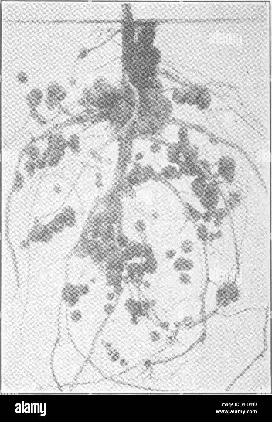 Bacterial nodules hi-res stock photography and images - Alamy