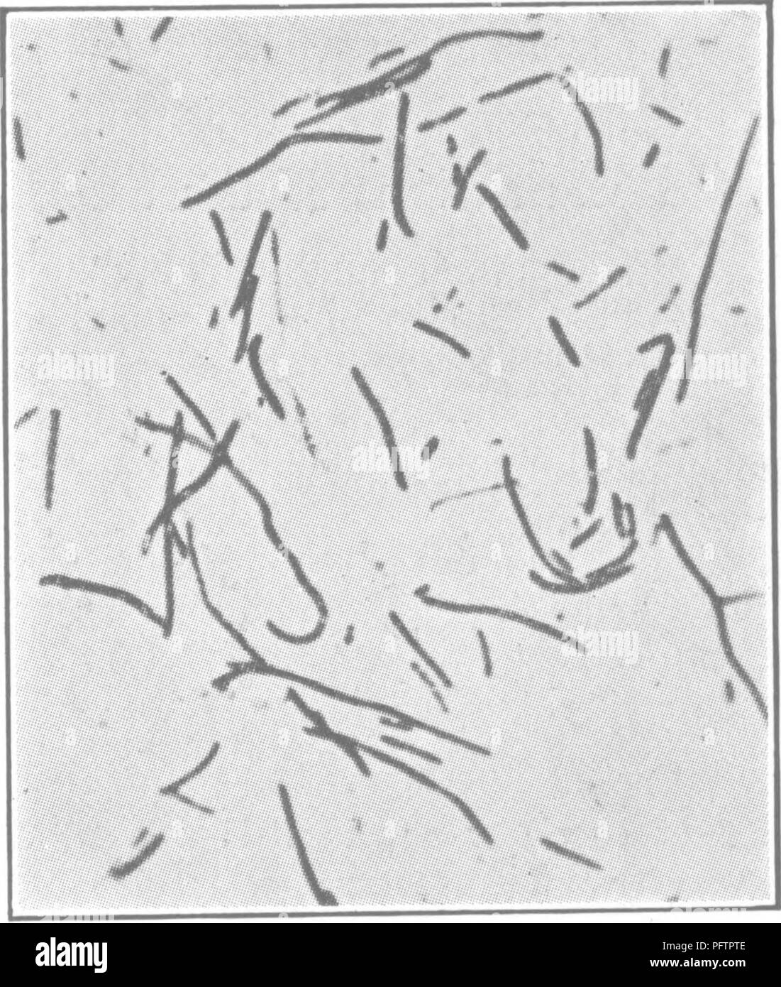 Spiral, round or cocci bacteria Black and White Stock Photos & Images ...