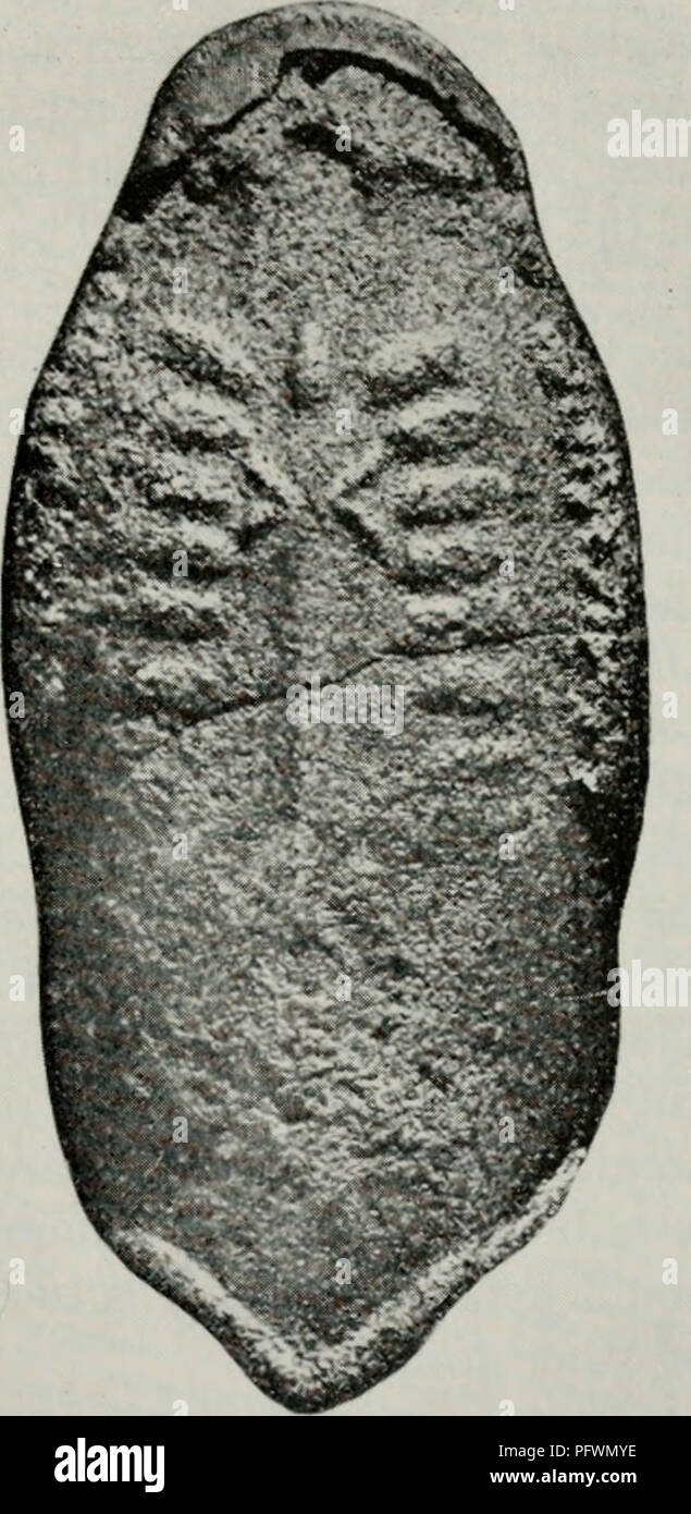 Cranial fossa hi-res stock photography and images - Alamy