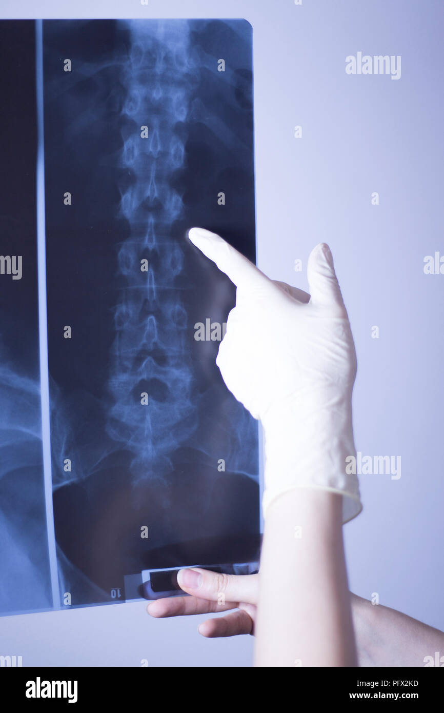 Medical hospital x-ray lowe back pain spine and hips traumatology scan ...