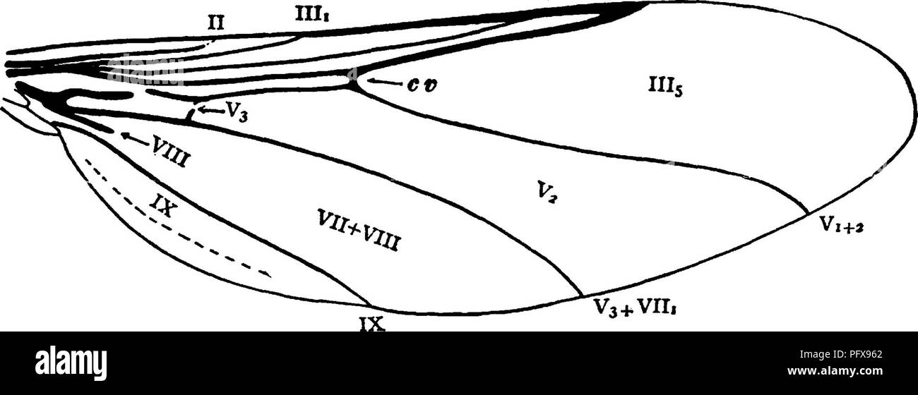 Frontal suture hi-res stock photography and images - Alamy