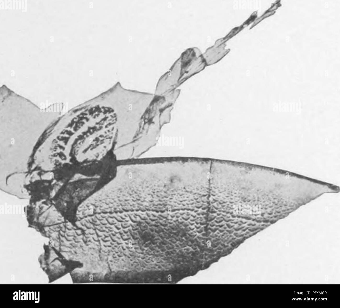 Preabdomen hi-res stock photography and images - Alamy