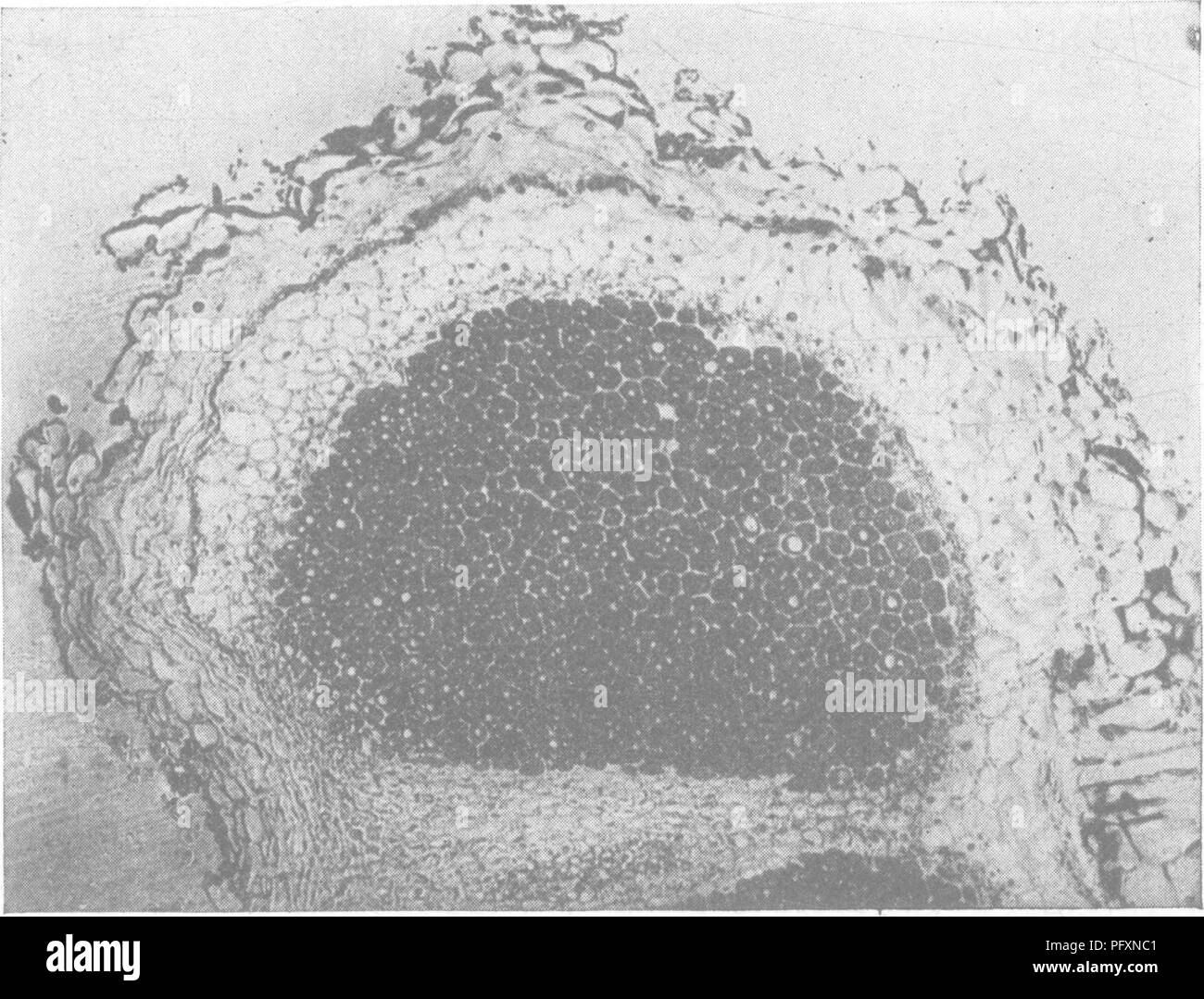 Bacteria nodule legume Black and White Stock Photos & Images - Alamy