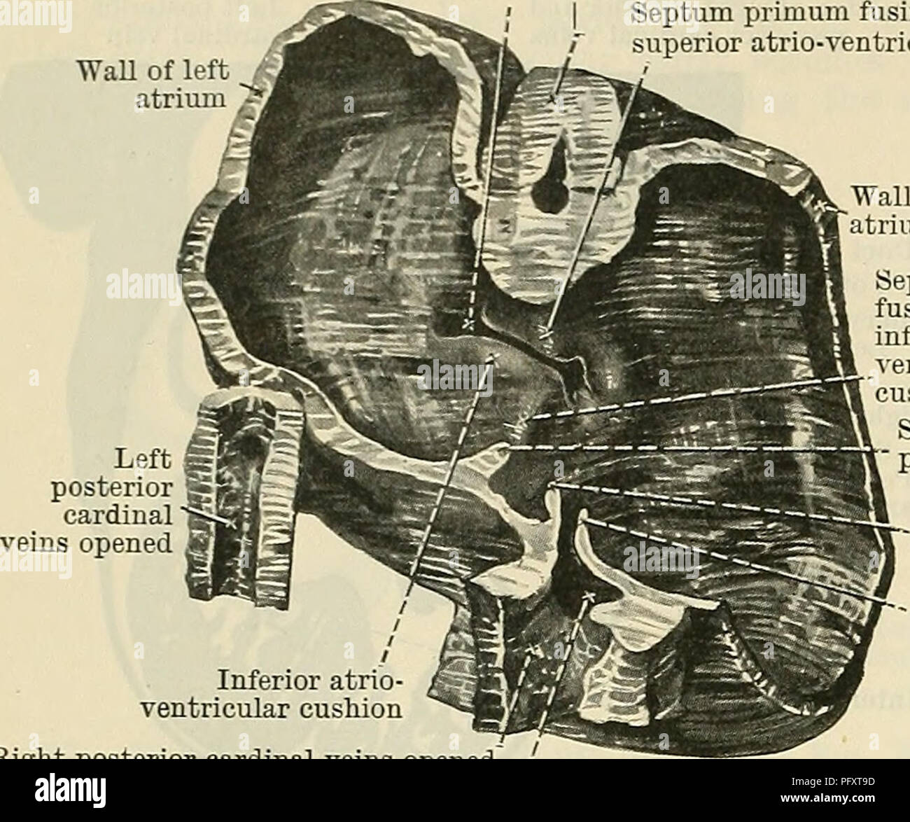 Right ventricular atrium hi-res stock photography and images - Alamy