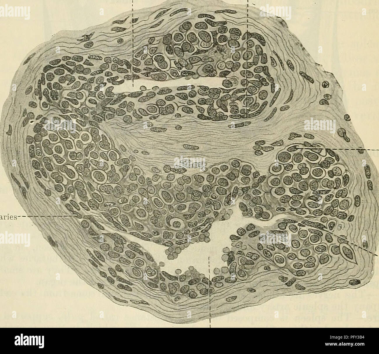 An anatomical illustration showing the structure of the spleen, with ...