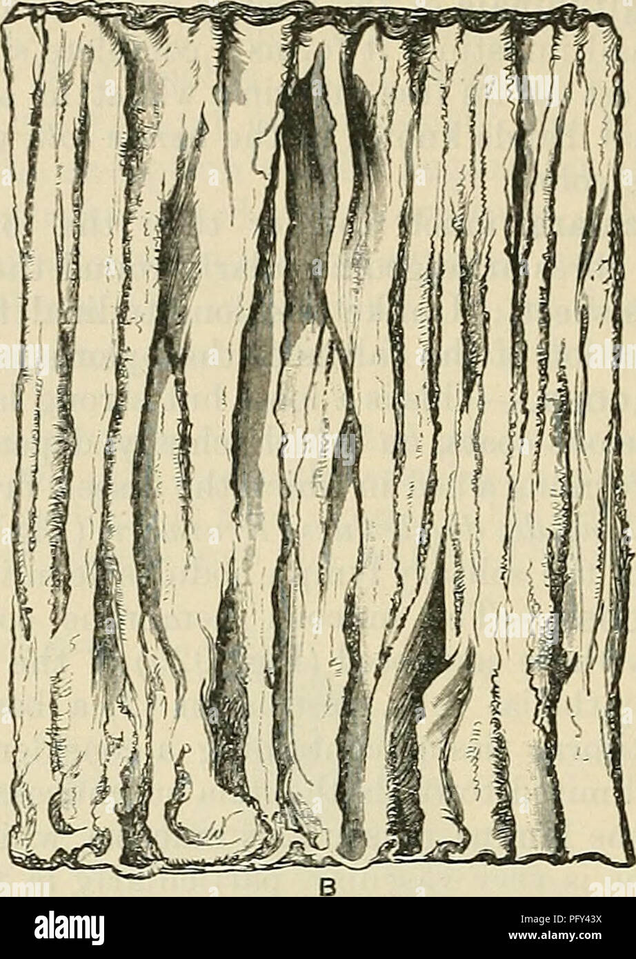 This anatomical illustration from Cunningham's Text-book highlights the ...