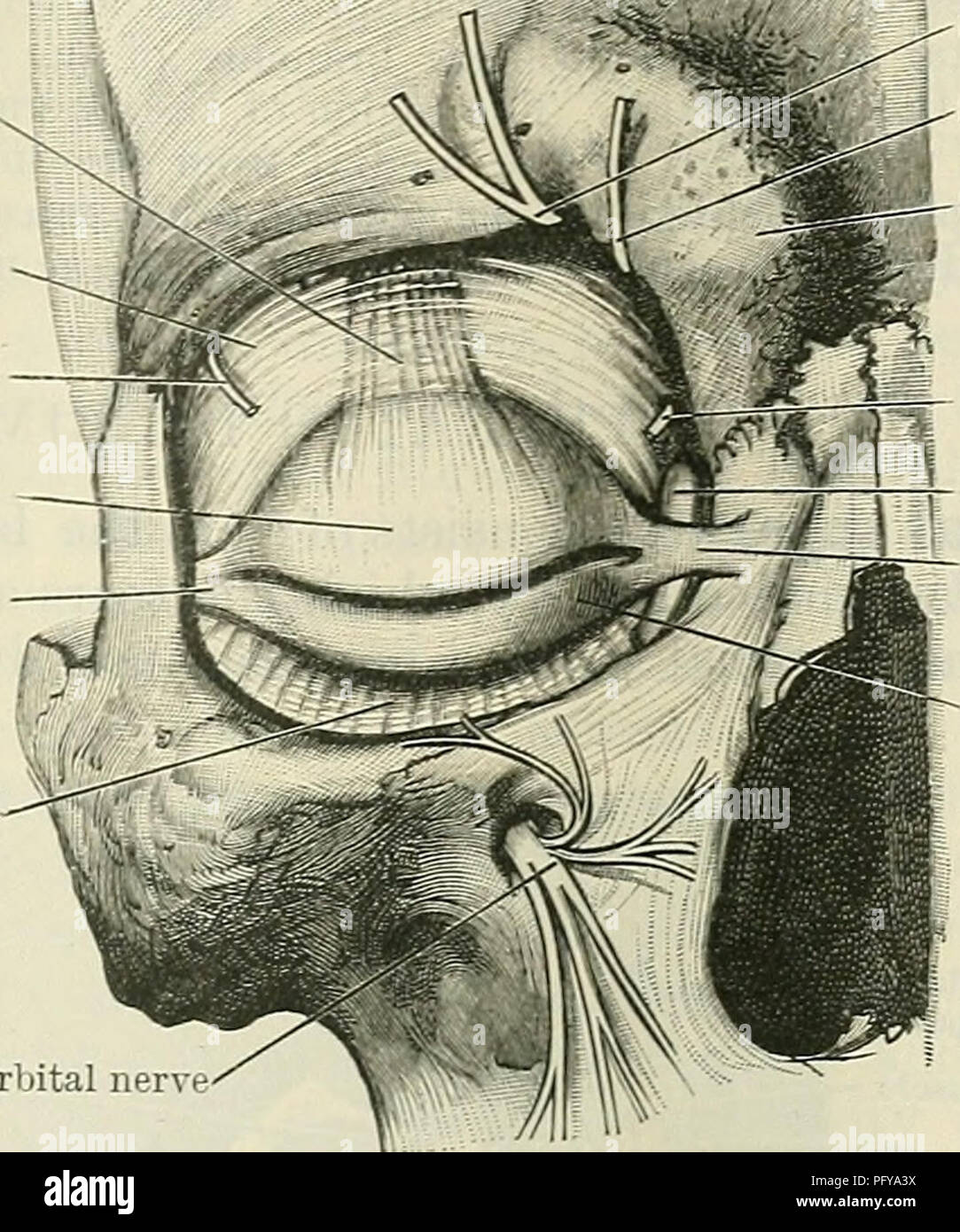 Medial Palpebral Ligament