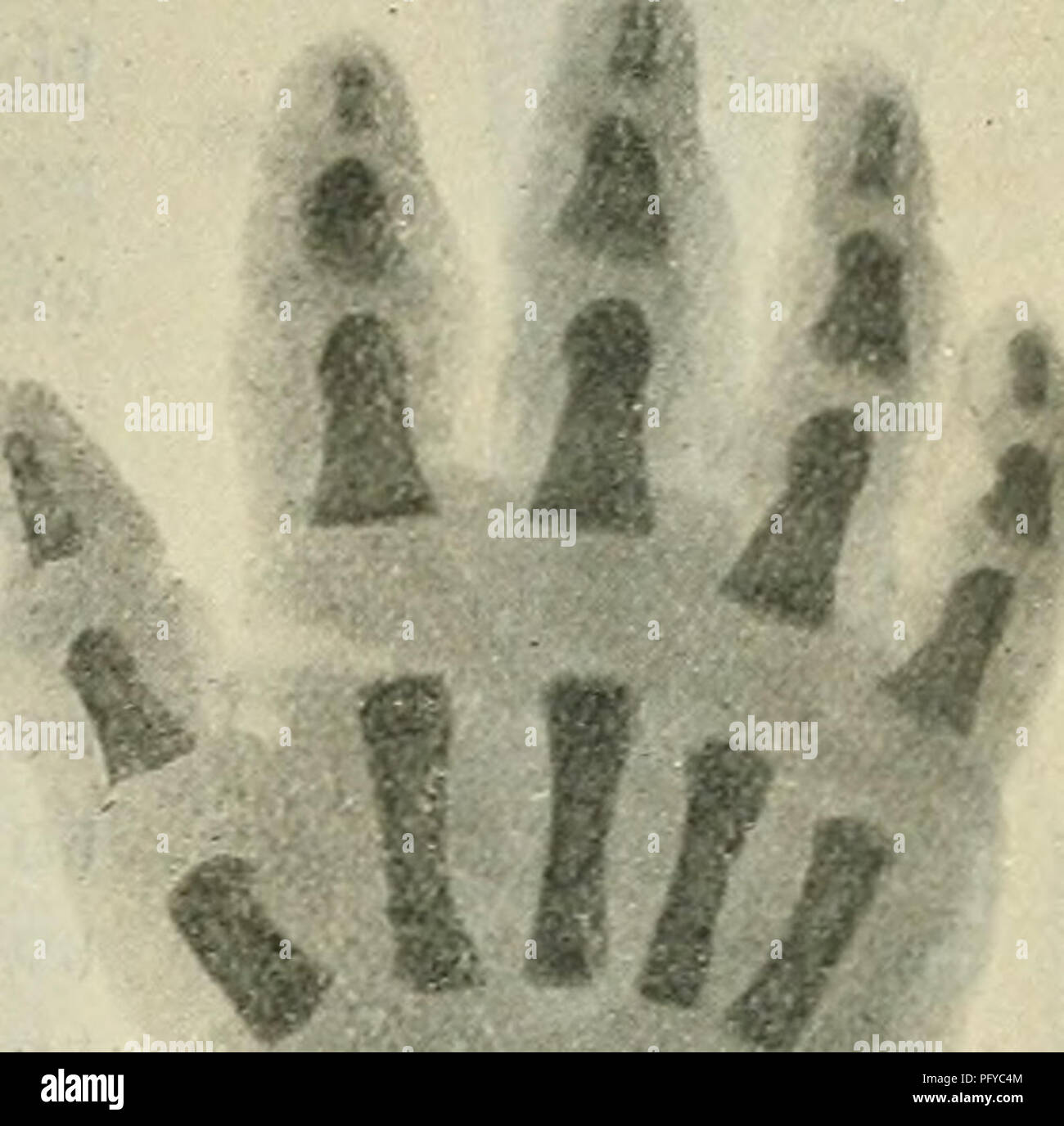 . Cunningham's Text-book of anatomy. Anatomy. /Capitate bone Fig. 220 ...