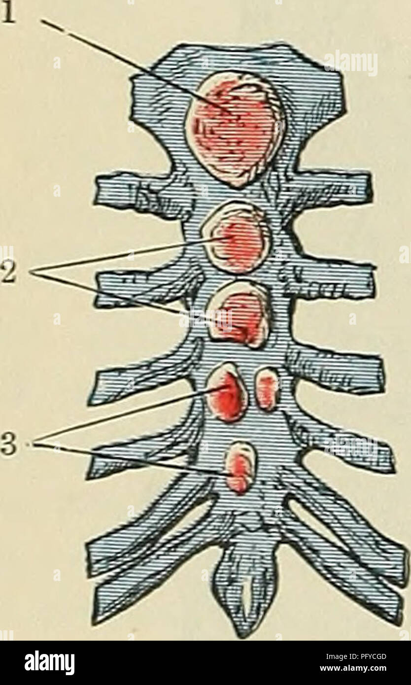 . Cunningham's Text-book of anatomy. Anatomy. 108 OSTEOLOGY. border ...