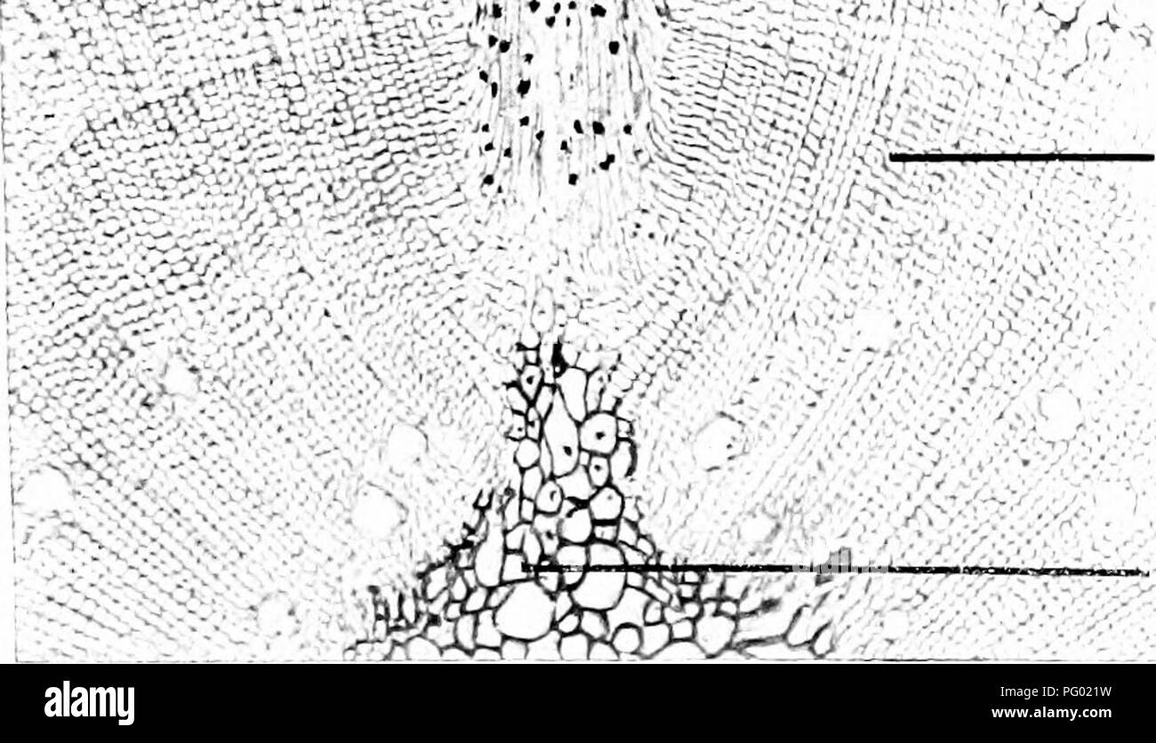 This photomicrograph depicts various stages of development in the wood ...