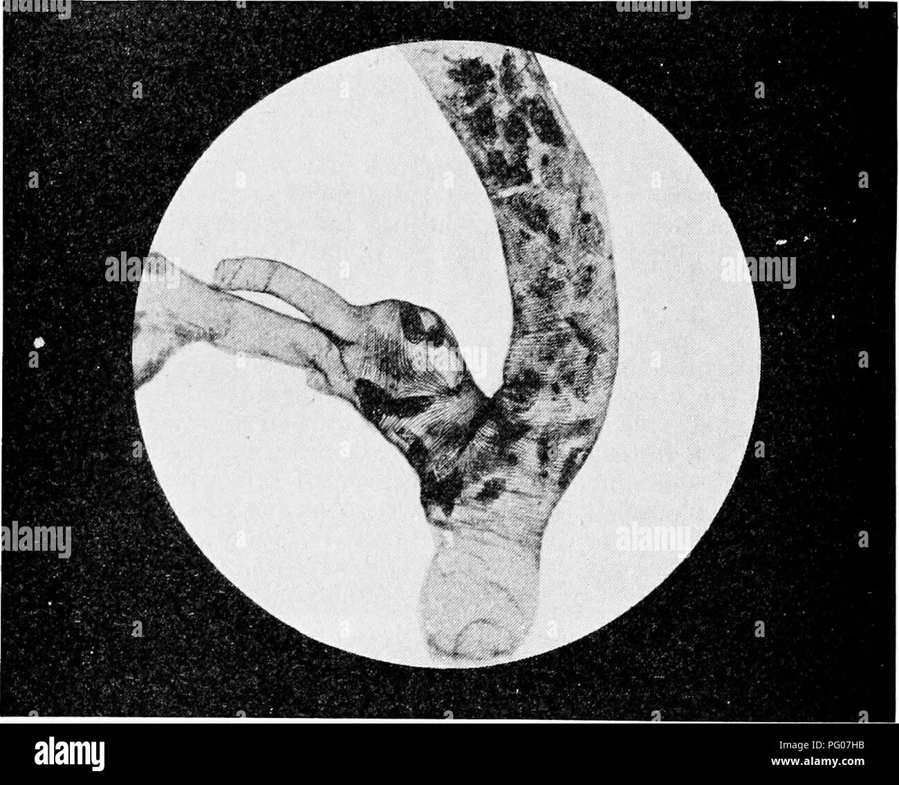 This image describes acarine disease in bees, a common condition caused ...