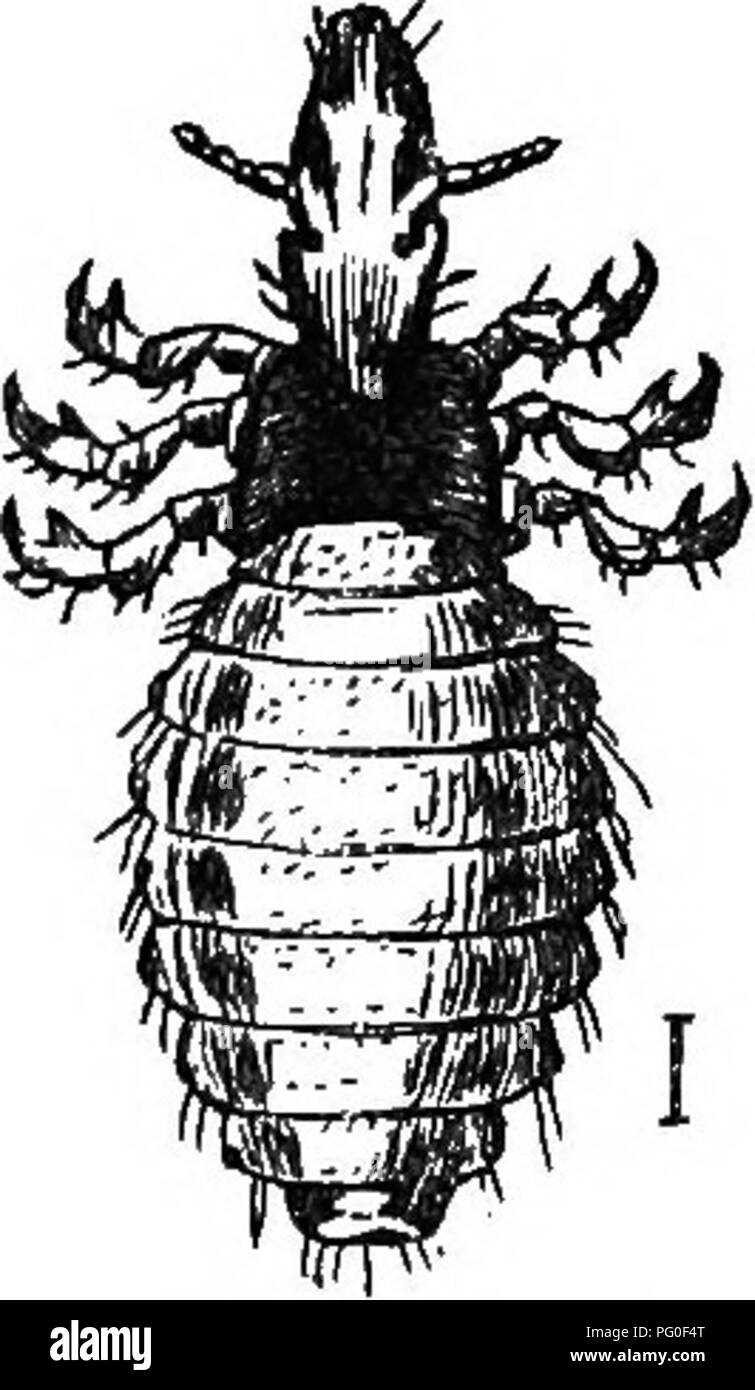 Biting human lice hi-res stock photography and images - Alamy