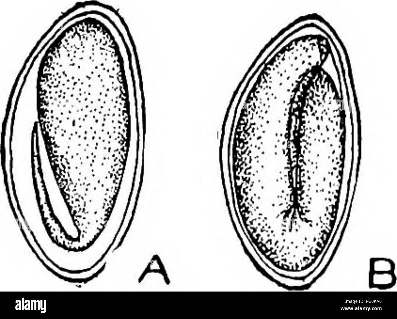 Parasites and pinworms hi-res stock photography and images - Alamy