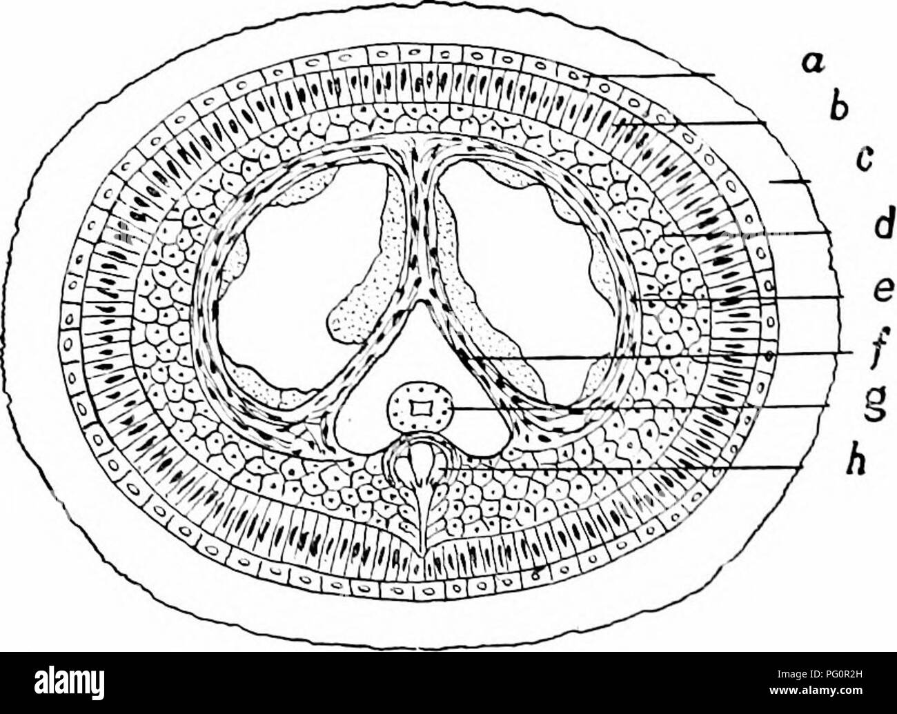 Guinea Worm S S
