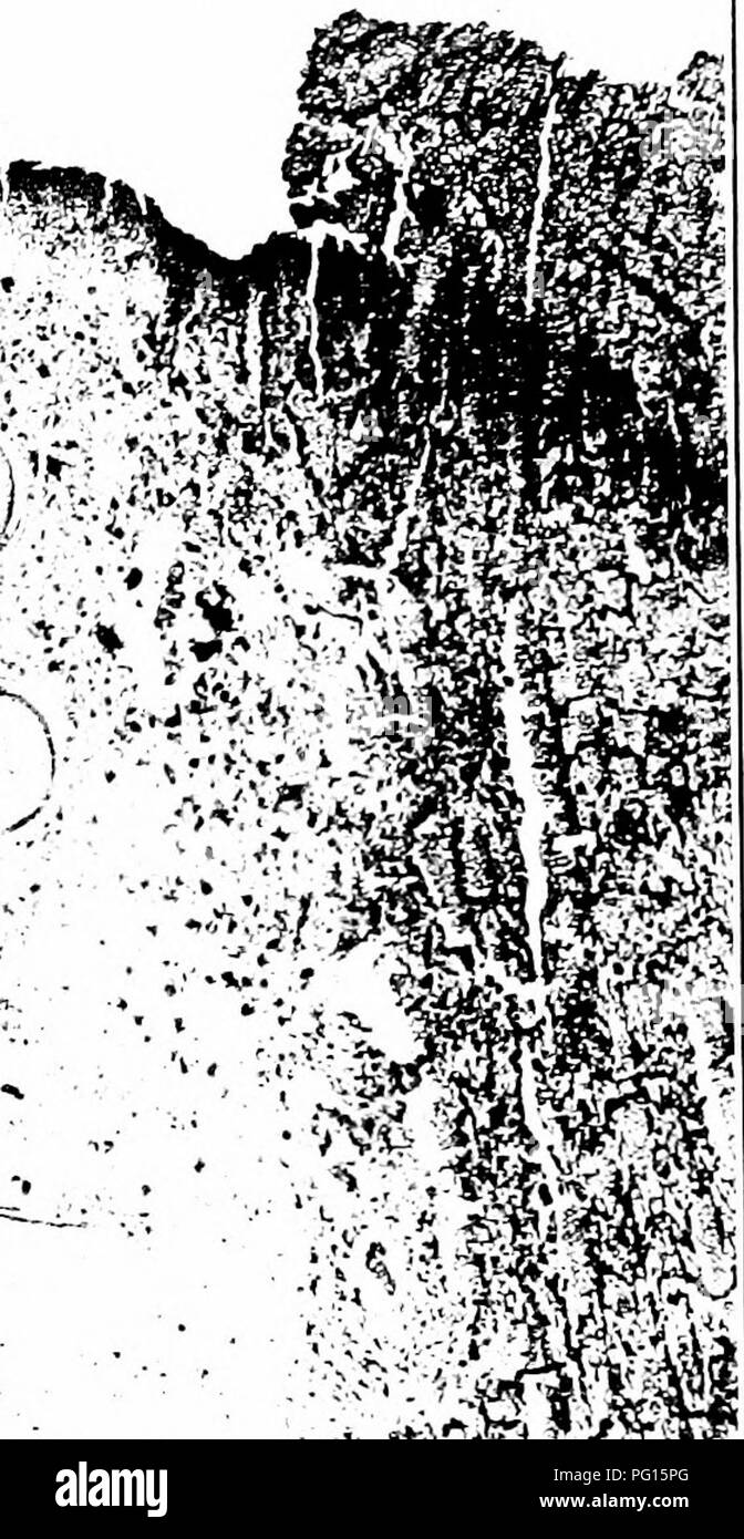 This image shows the devastating effects of chestnut blight, a fungal ...