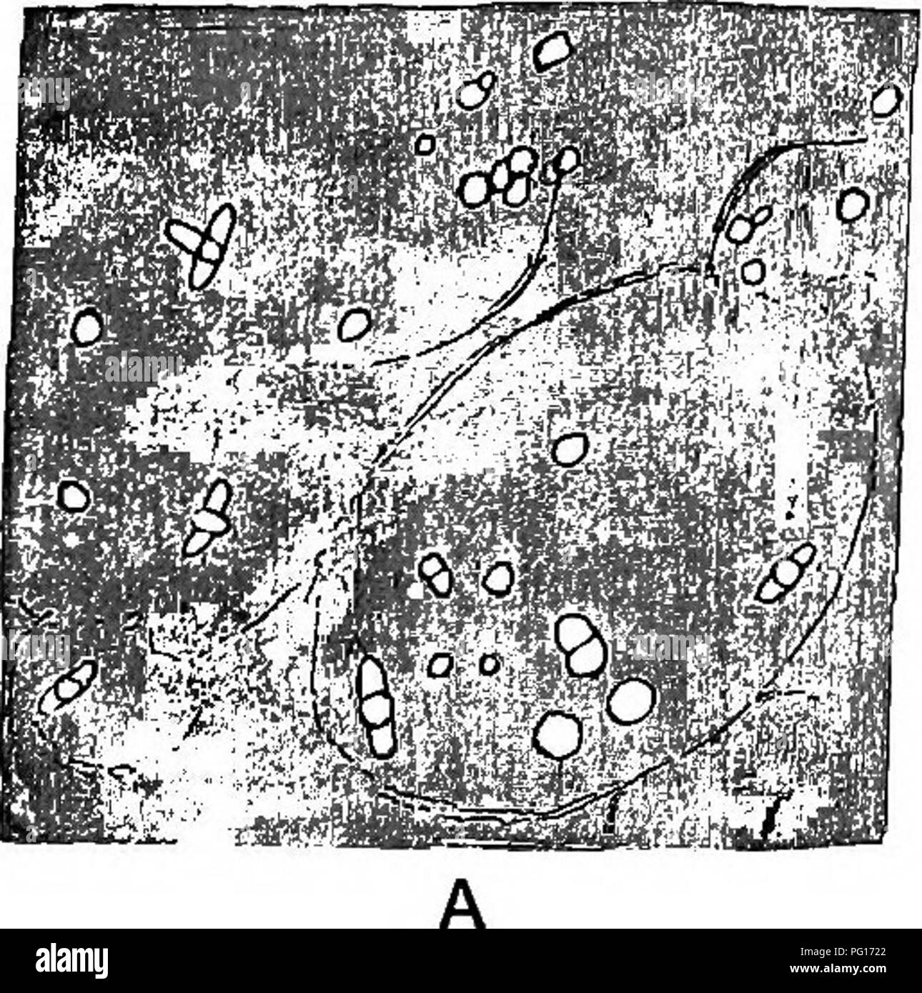 Micrococcus hi-res stock photography and images - Alamy
