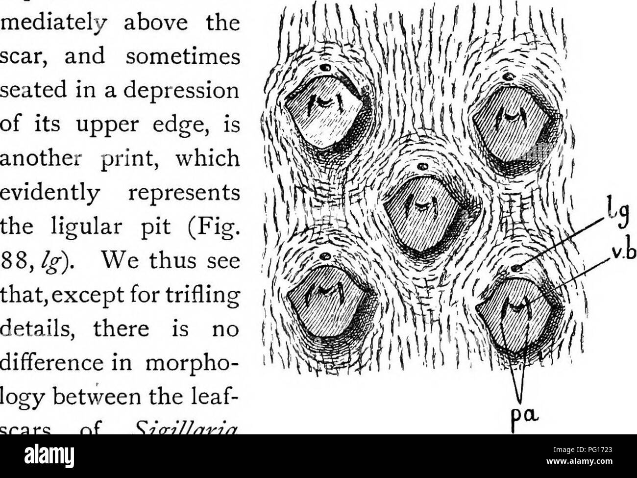 Vascular Bundle Scar
