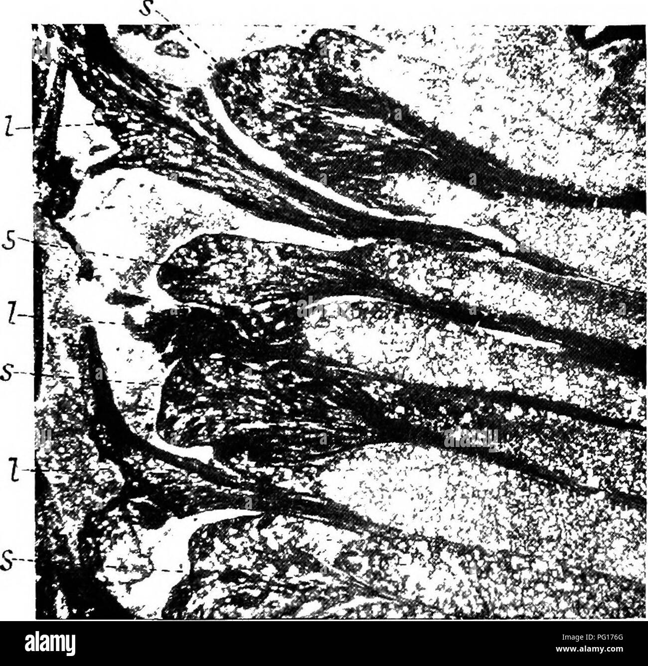 Distal section hi-res stock photography and images - Alamy