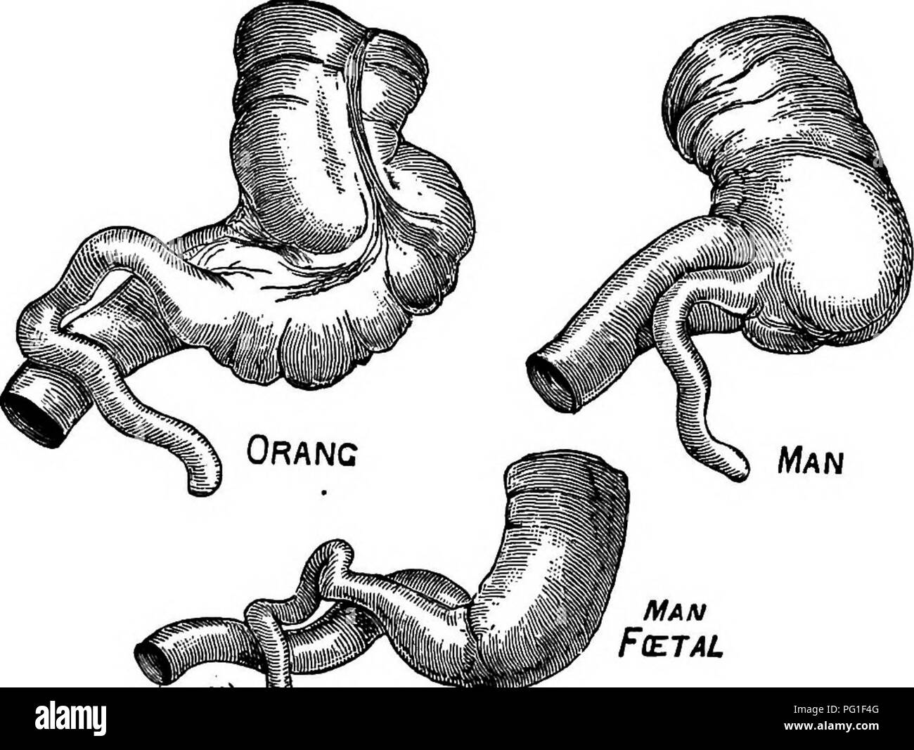 Appendix vermiformis hi-res stock photography and images - Alamy