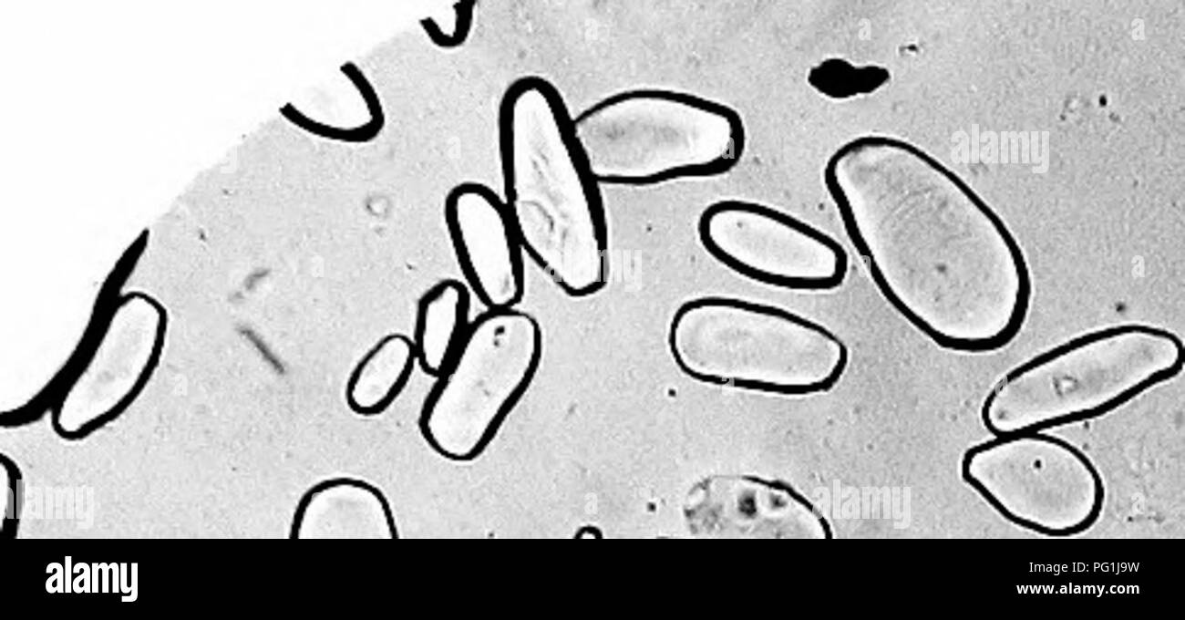 This image illustrates the primary types of starches used in food ...
