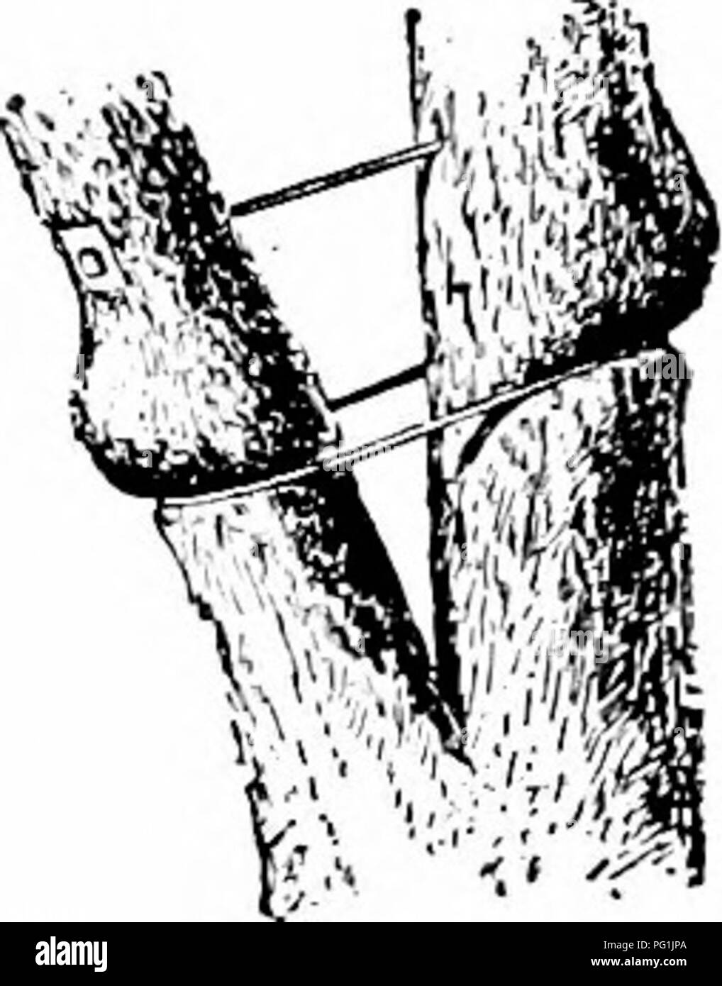 Bridge grafting hi-res stock photography and images - Alamy