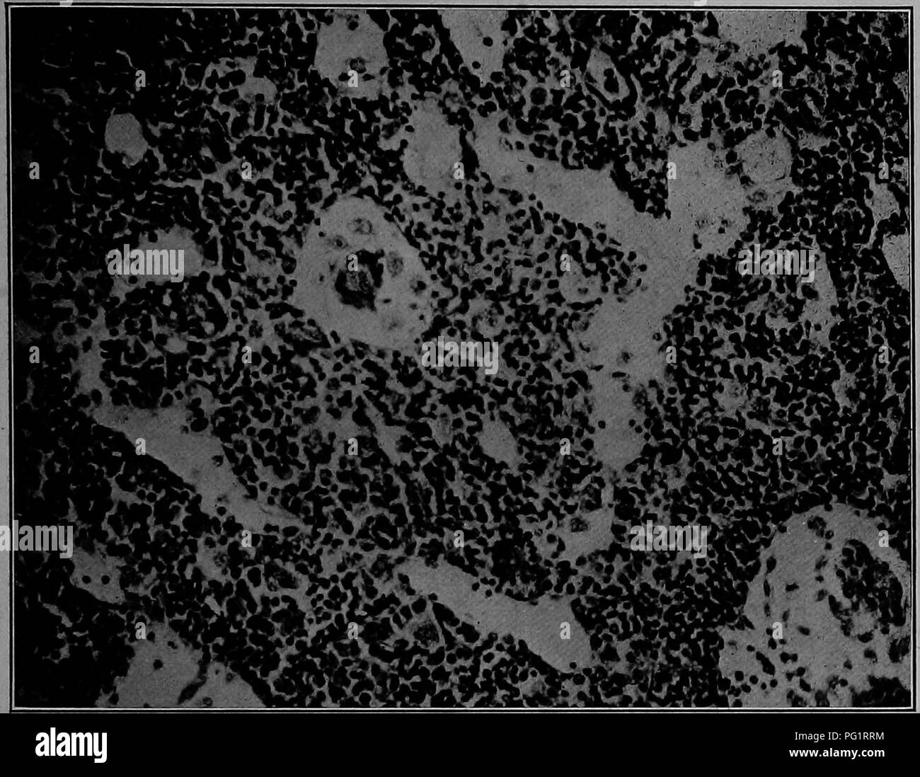 Trabeculae Black and White Stock Photos & Images - Alamy