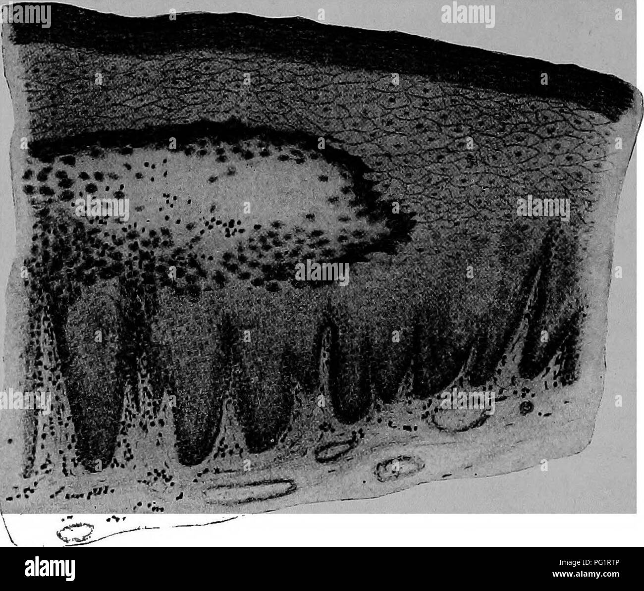 . The pathology and differential diagnosis of infectious diseases of ...