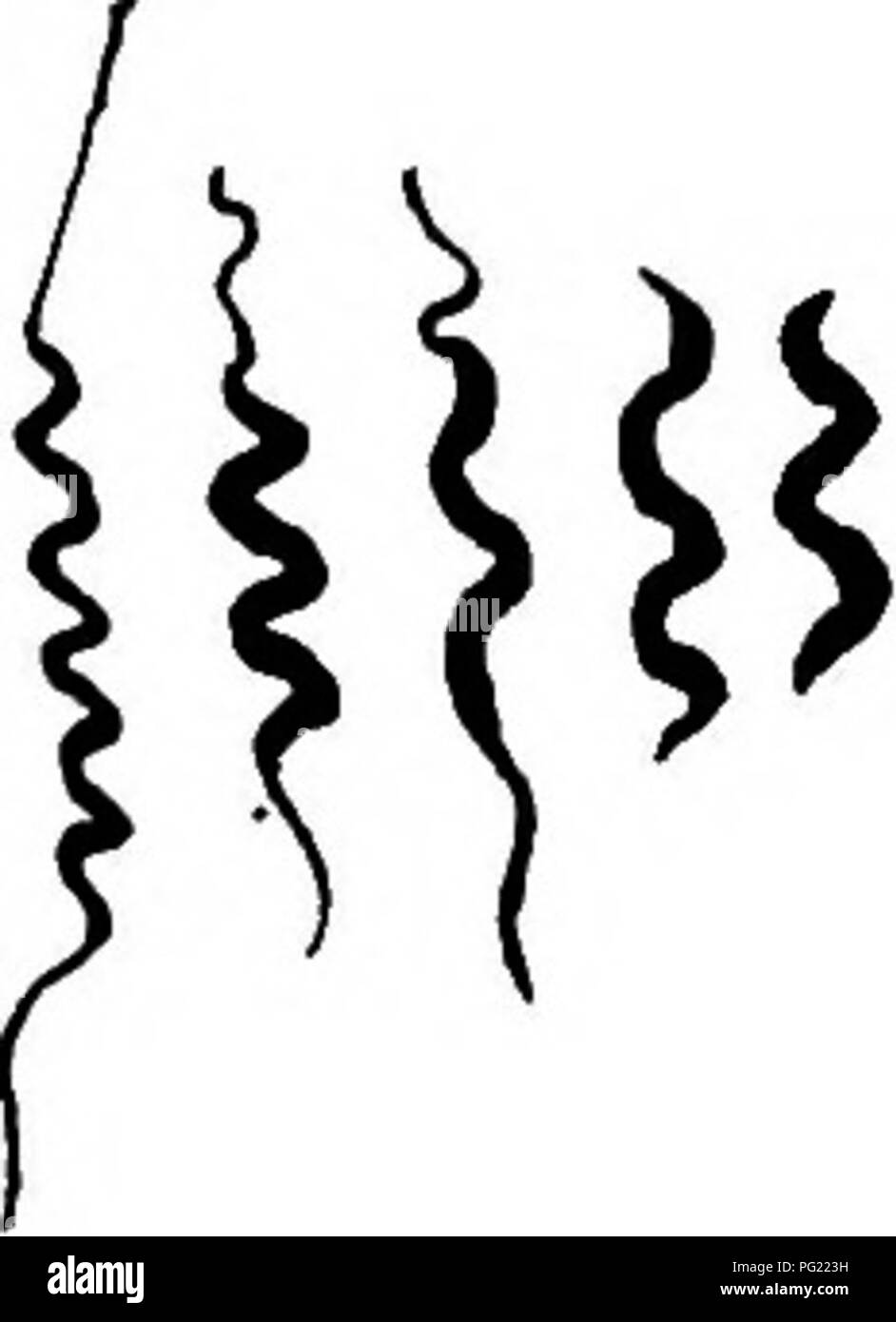 A study on rat-bite fever, an infection transmitted through rat bites ...