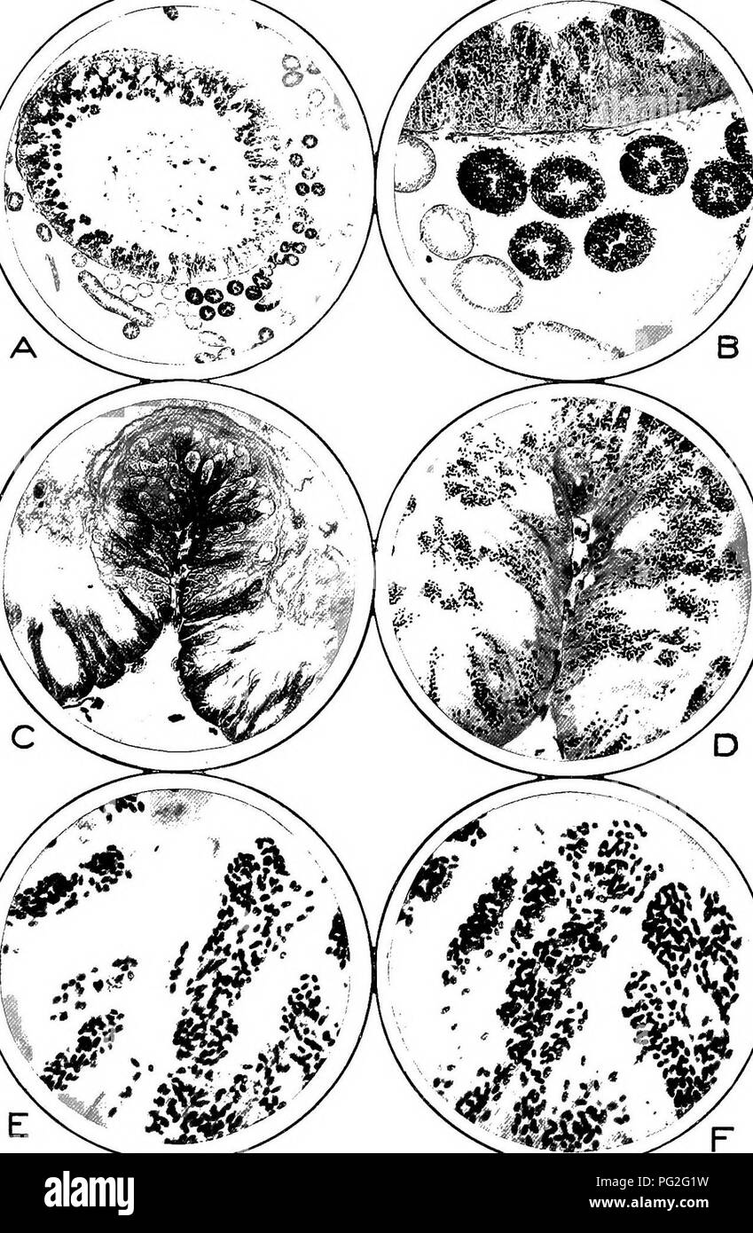 This image shows a detailed examination of Nosema disease in honeybees ...