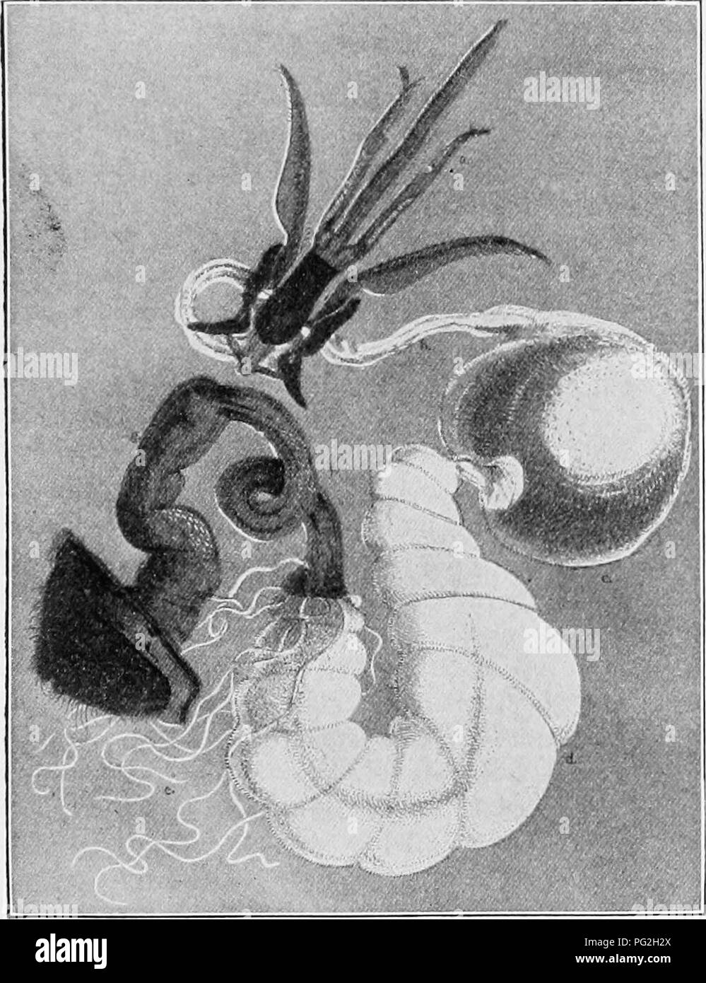 15 small intestine hi-res stock photography and images - Alamy