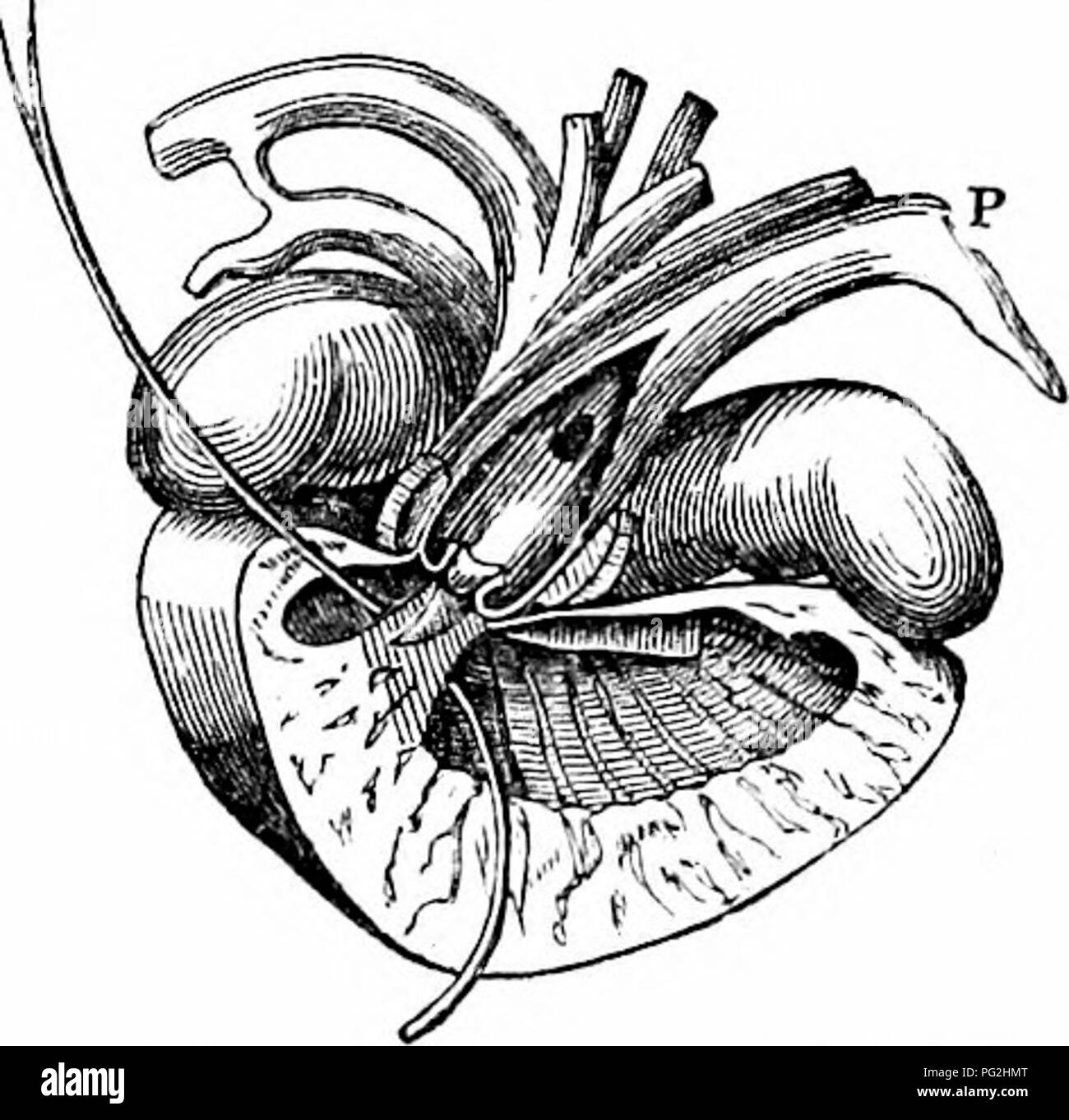 Serous membrane hi-res stock photography and images - Alamy