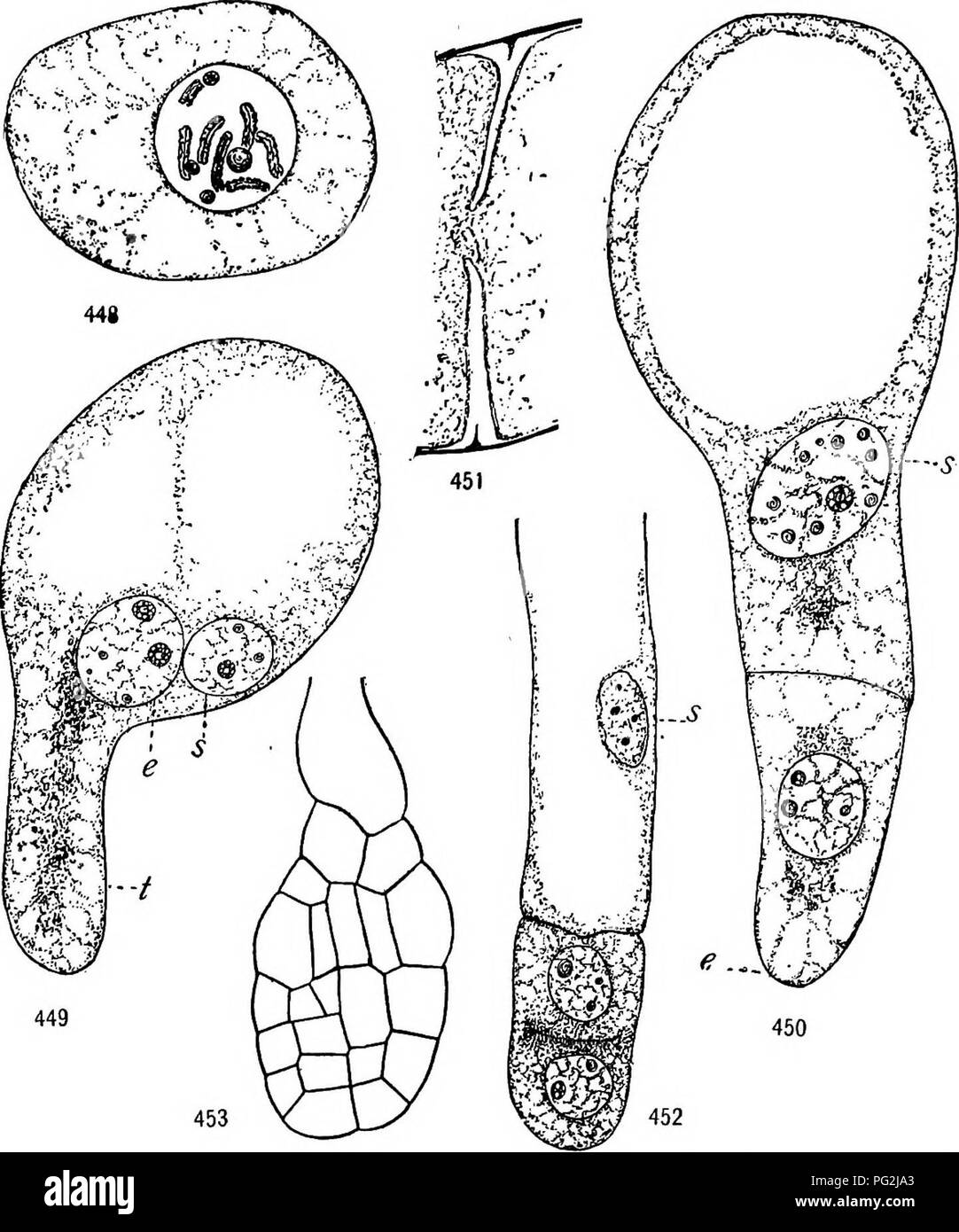 Gymnosperm Embryo