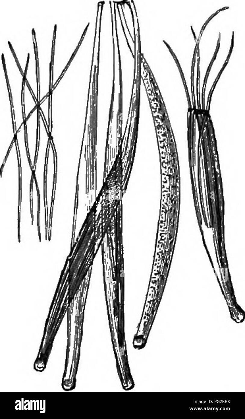 This illustration shows a magnified view of a perithecium of ...